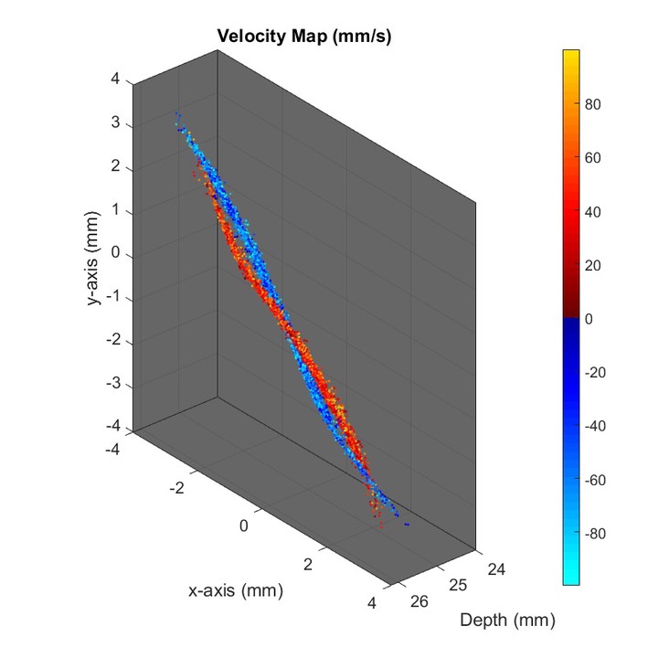 Velocity tracking for super-resolution ultrasound imaging | Sevan Harput